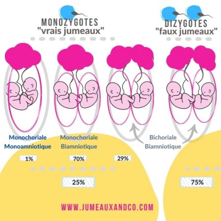 grossesse gémellaire échographie | Jumeaux & Co le site des parents de ...